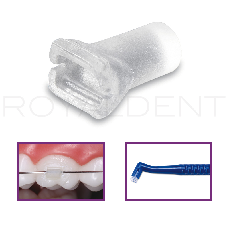 Mini mold realizar tubos linguales Reliance Orthodontics - Royal Dent